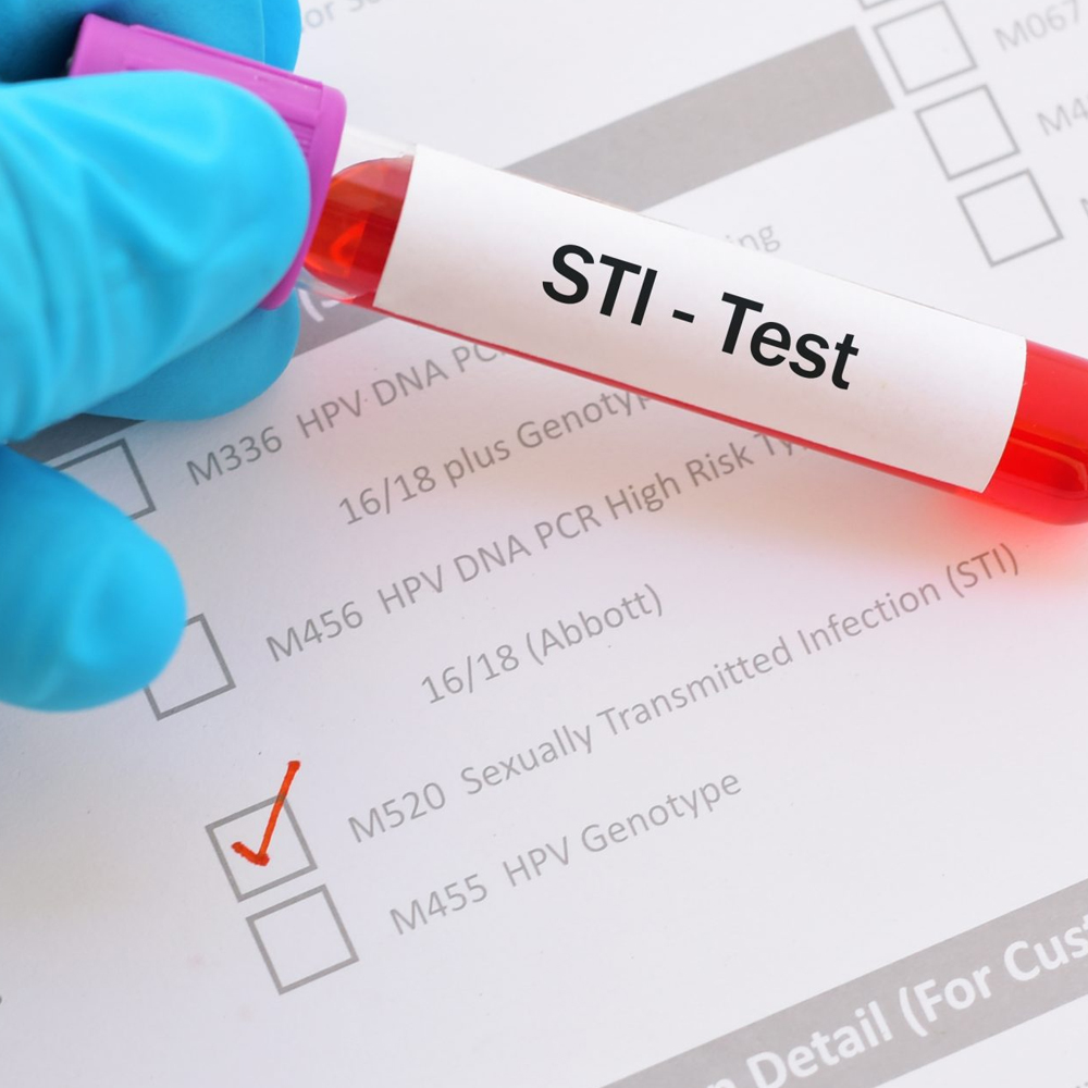 Ministry of Health & Wellness National HIV/STI/TB Programme